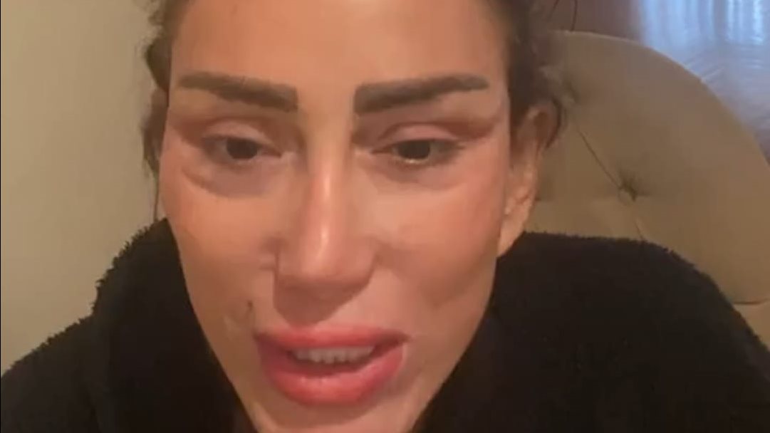 بعد واقعة ريهام سعيد .. 5 أسباب تؤدي لفشل عمليات التجميل