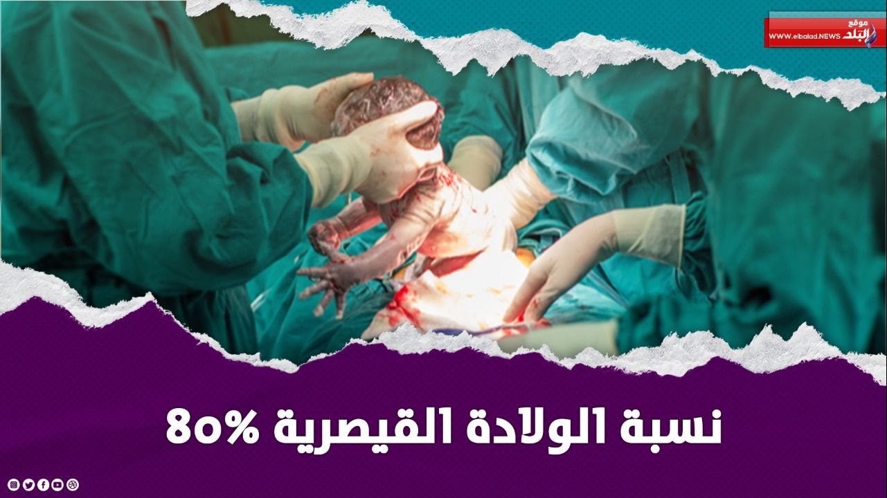 مصر الأولى على مستوى العالم الصحة تضع معايير الولادة القيصرية وتحذر